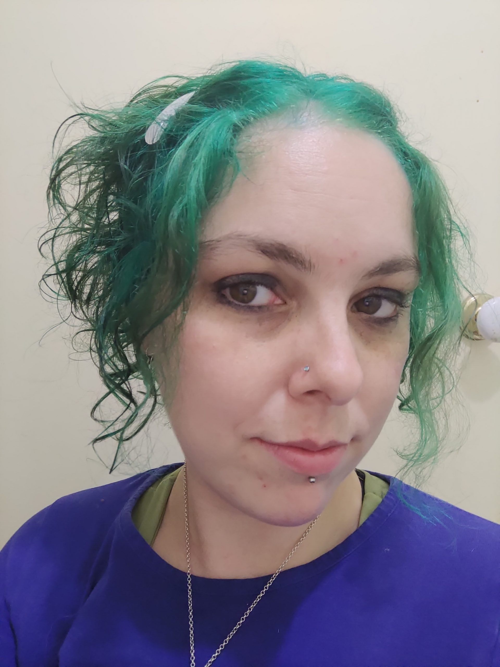 Mould in Lungs Highlights Serious Asthma Trigger